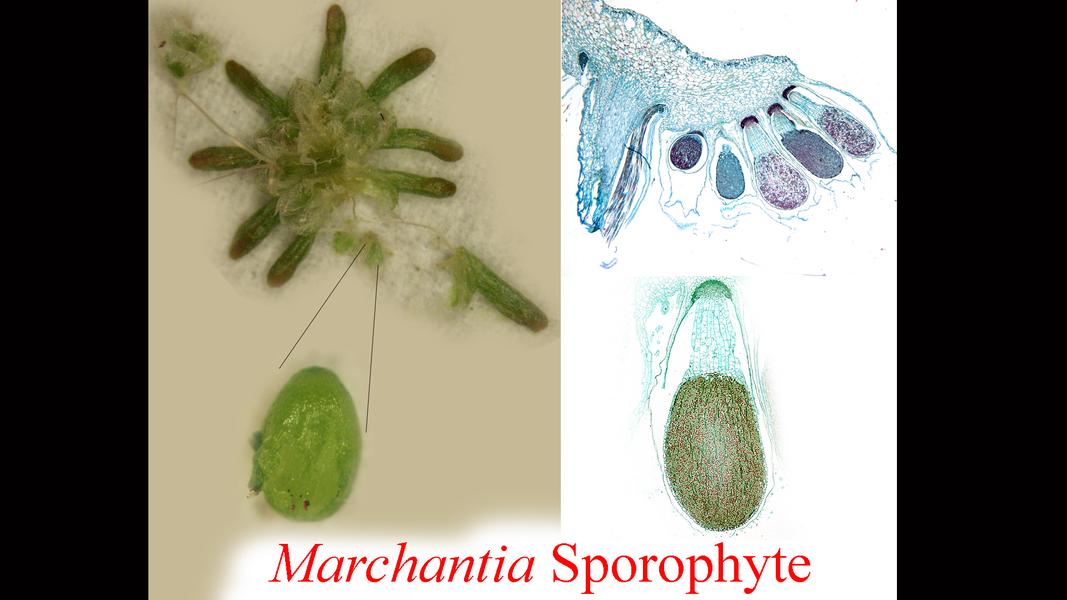 Marchantia Antheridia And Archegonia